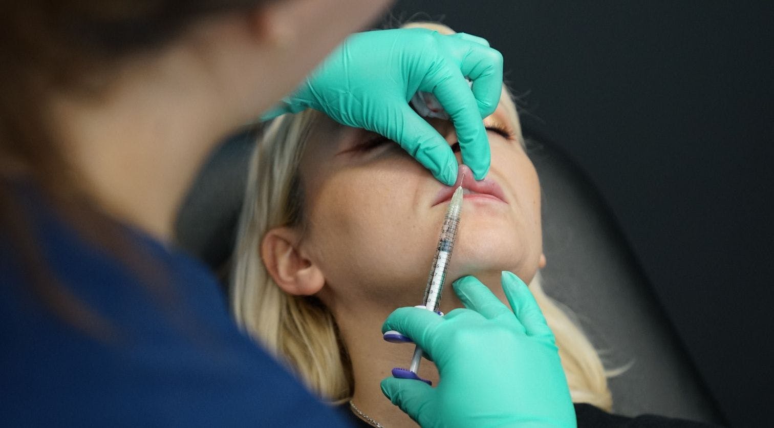 What Are the Main Causes of Lopsided Lip Filler Results?