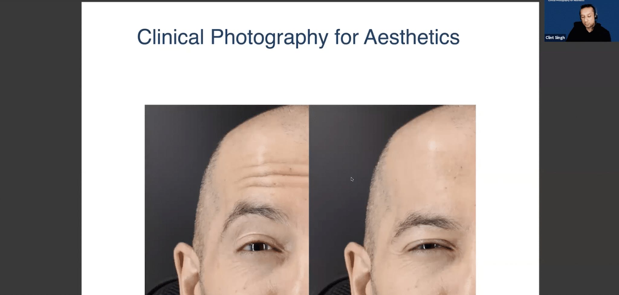 Clinical Photography For Aesthetics Practitioners