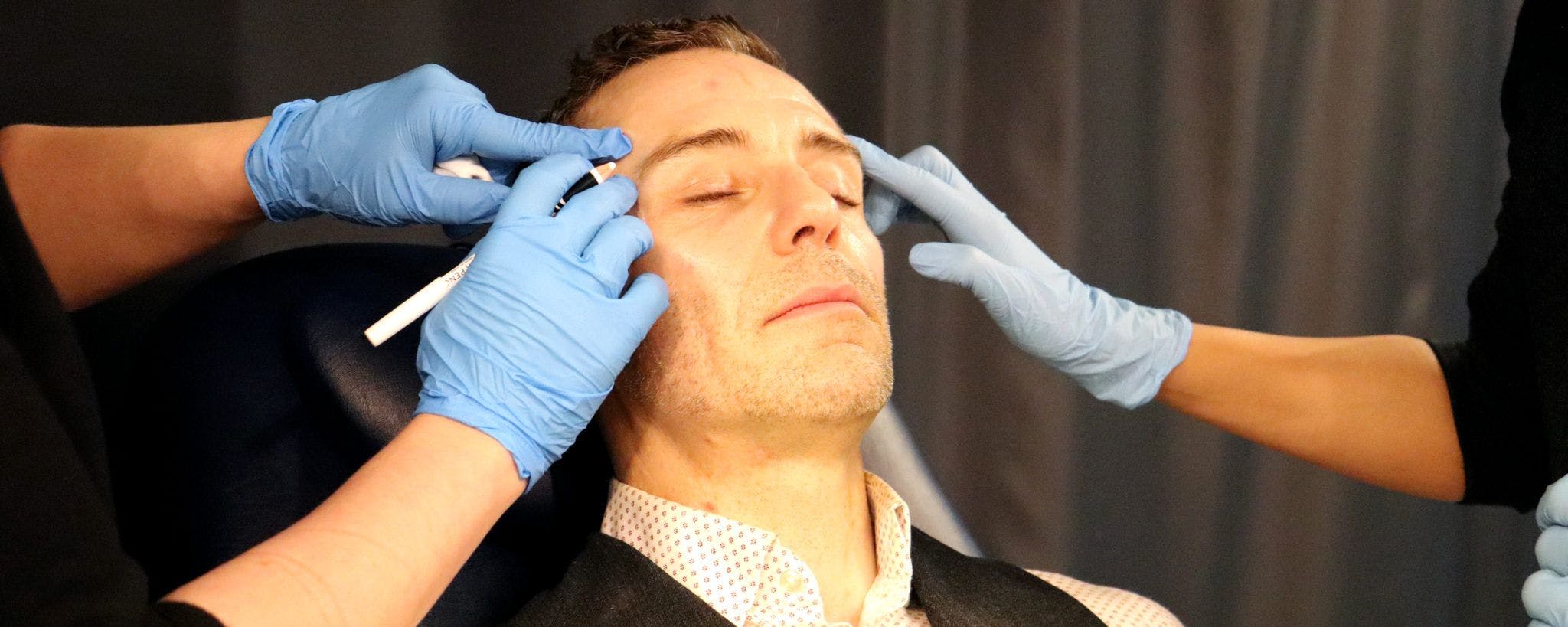 Why & How To Inject Temple Filler - Expert Advanced Aesthetics Tips