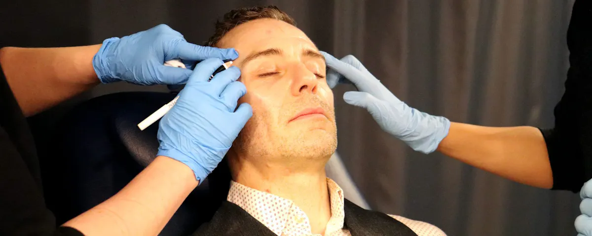 Why & How To Inject Temple Filler - Expert Advanced Aesthetics Tips