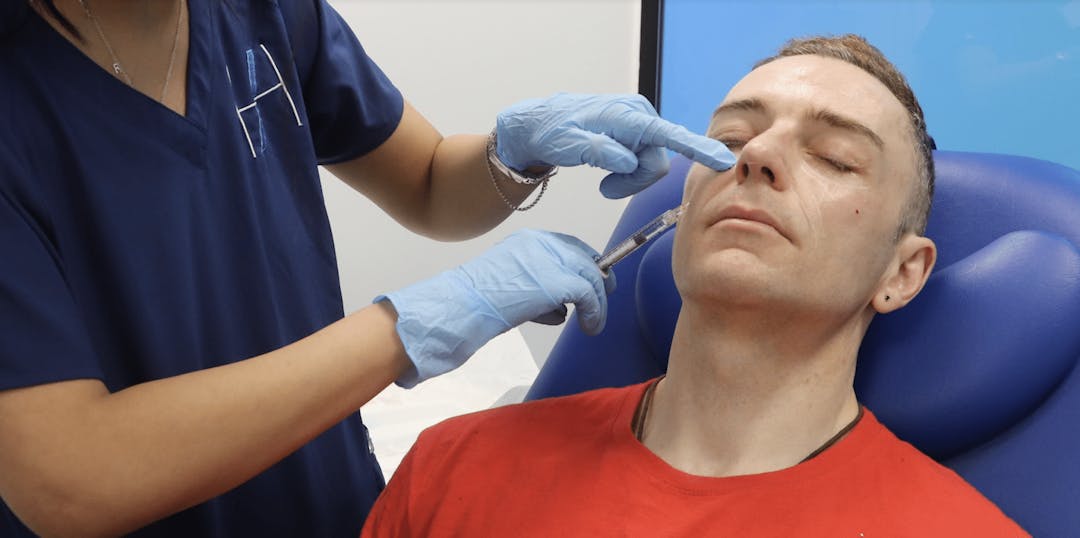 Mastering Marionette Line Filler Treatments | Harley Academy