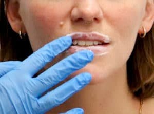 Should I Use A Block For Lip Filler? | Harley Academy