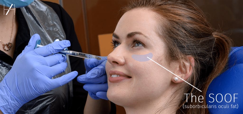 Expert Advice On Injecting The SOOF | Harley Academy