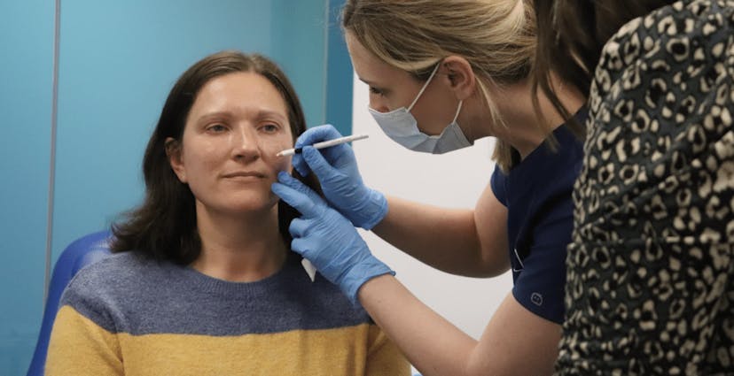 Marking Up For Cheek Filler | Harley Academy