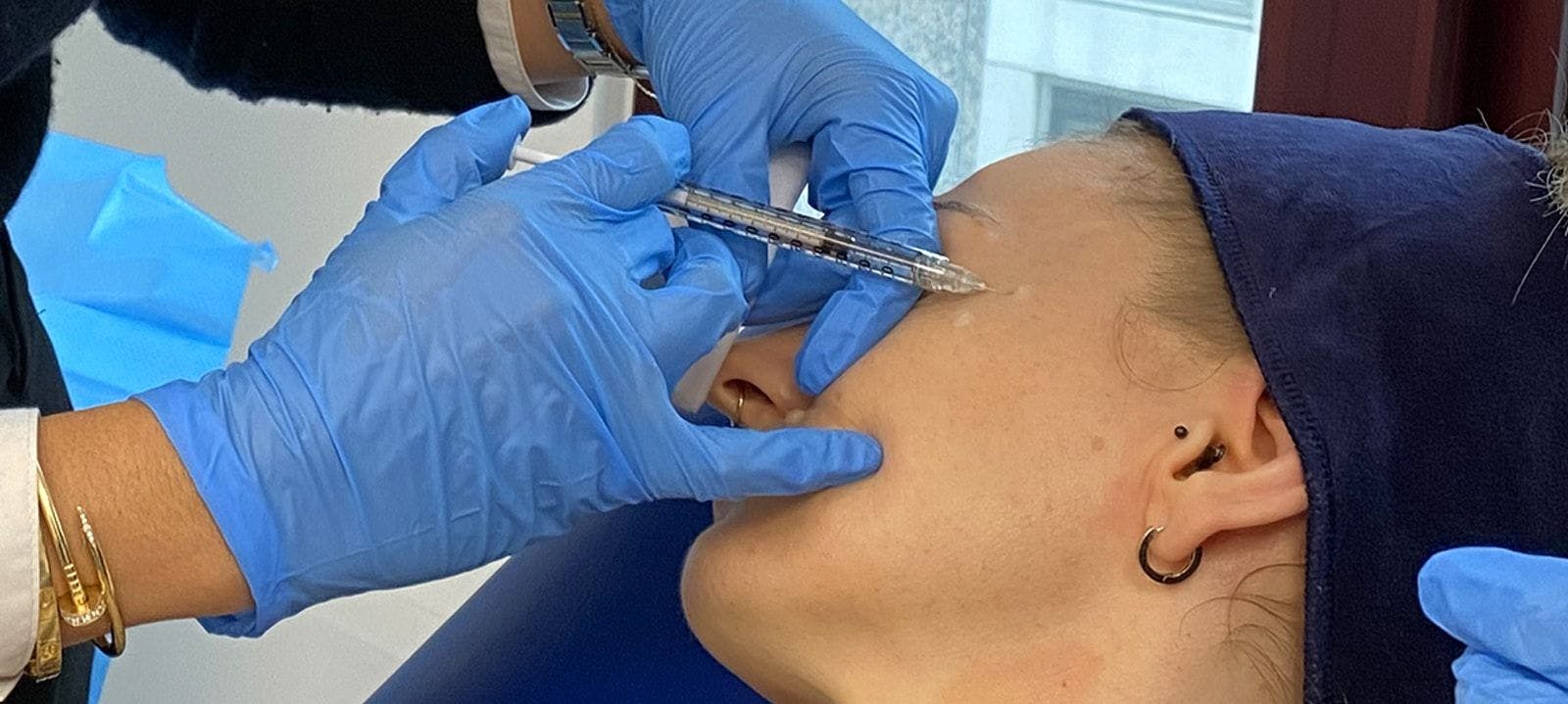 Cheek Filler: How To Prevent Bruising | Harley Academy