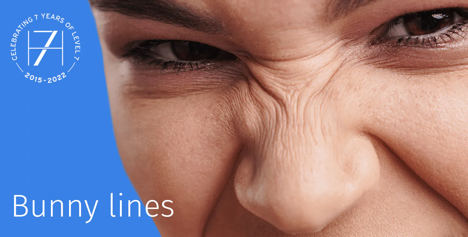 Learn how to treat Bunny Lines with Toxin