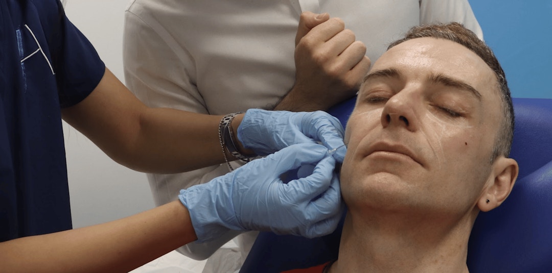 How to use a Cannula for Aesthetics Treatments