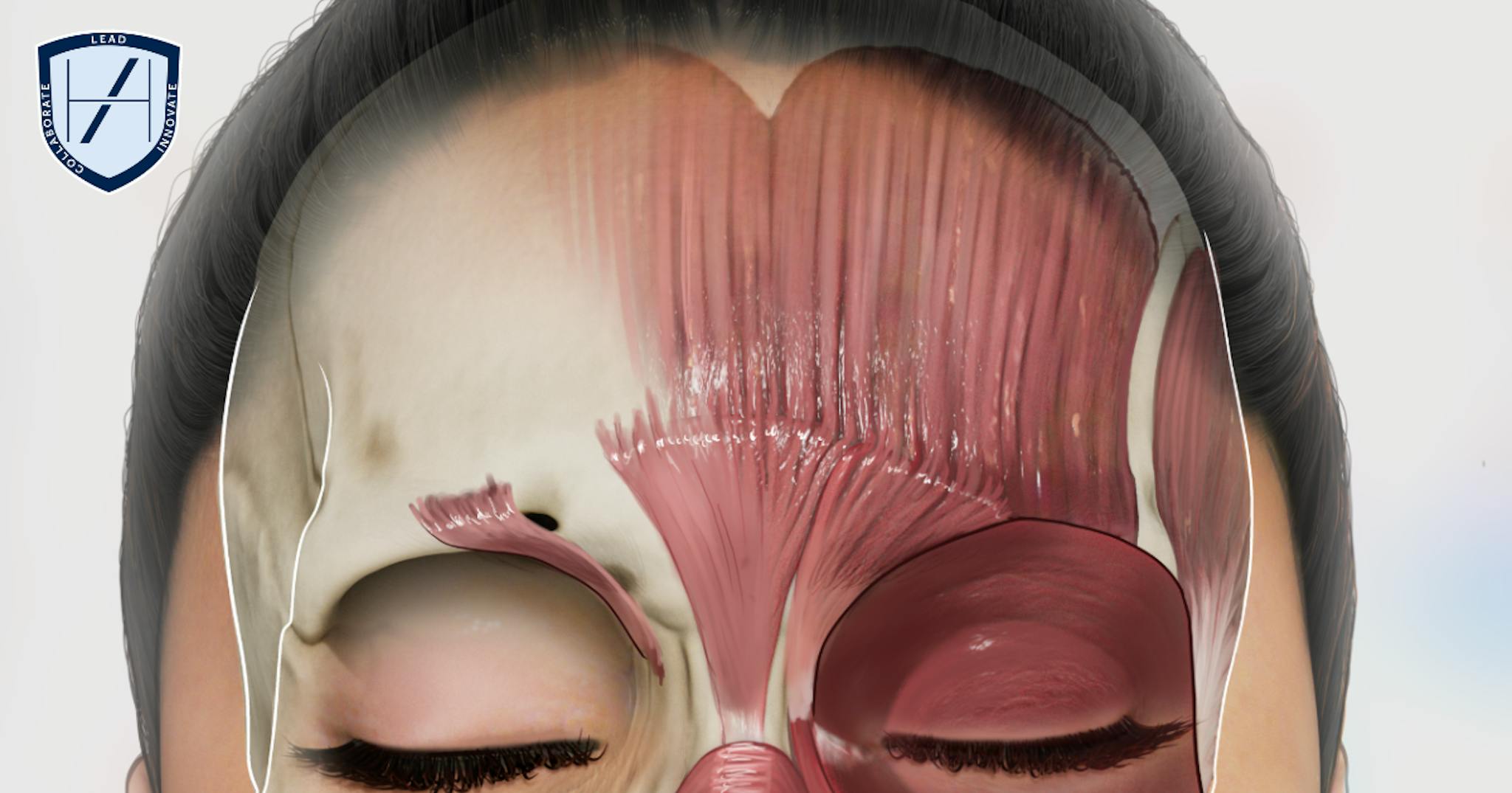 The Most High-Risk Injection Zones for Filler, Toxin & Biostimulators