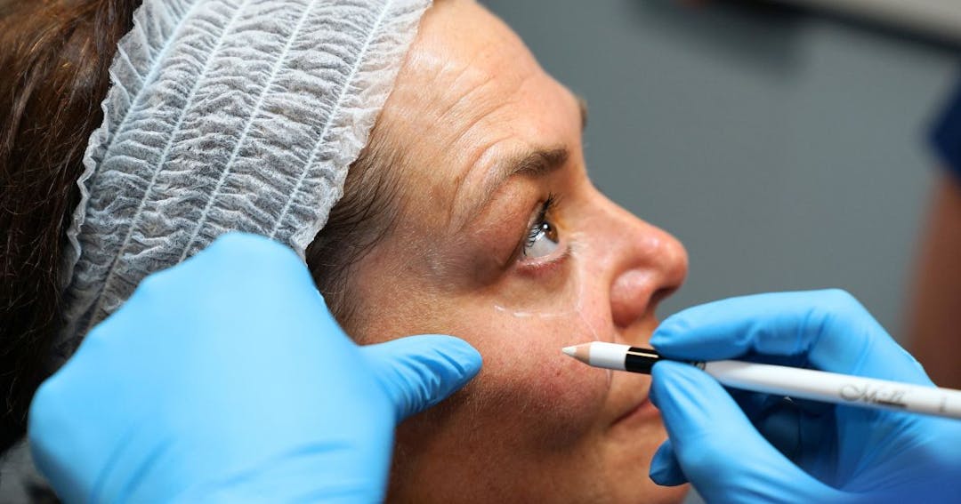 When to Use Tear Trough Filler Versus Polynucleotides | Harley Academy