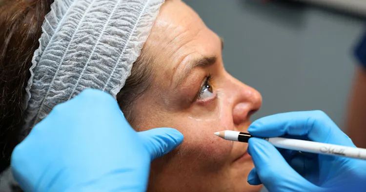 When to Use Tear Trough Filler Versus Polynucleotides | Harley Academy
