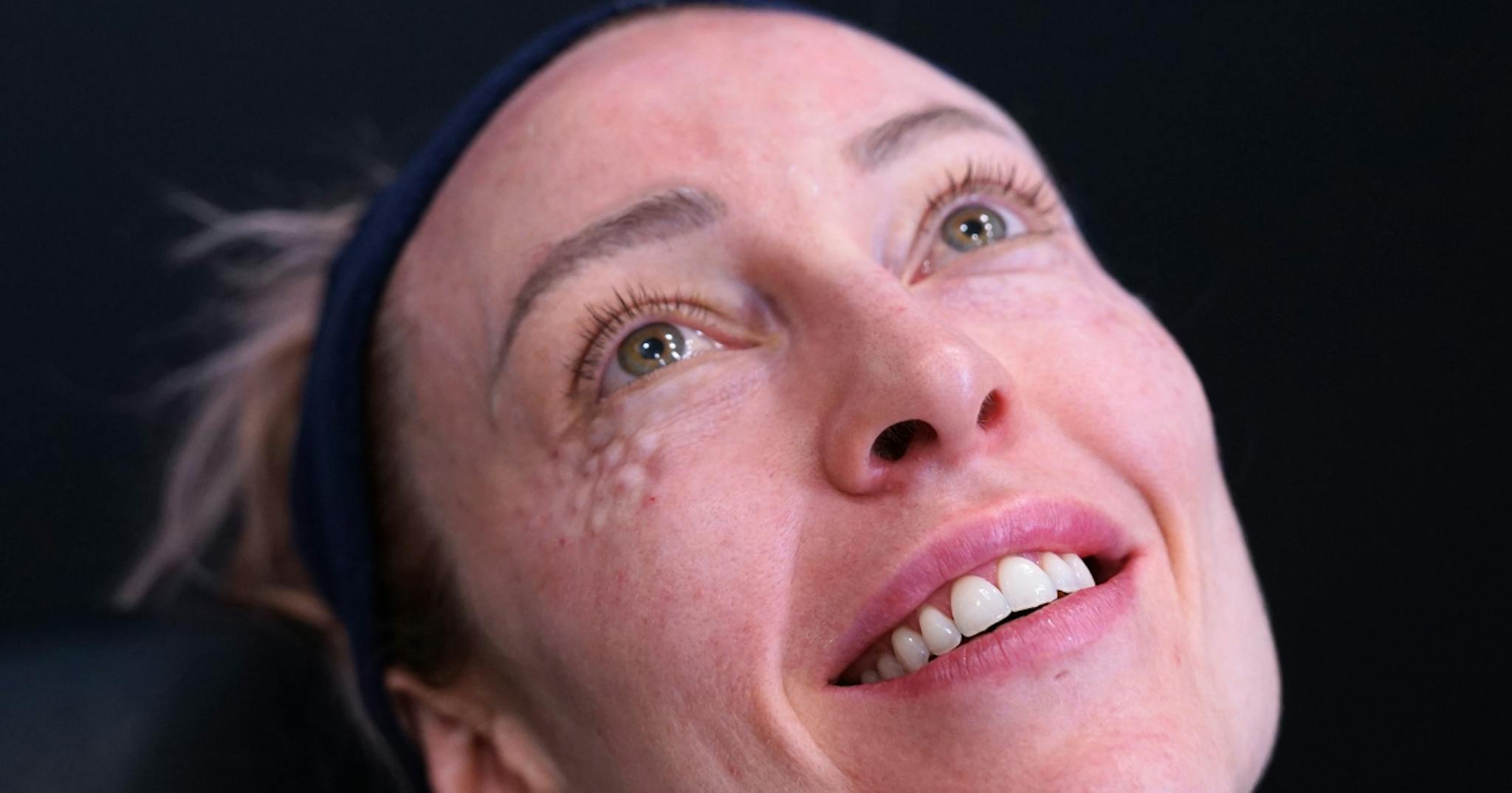 Guide to Polynucleotide Skin Boosters for Aesthetic Practitioners