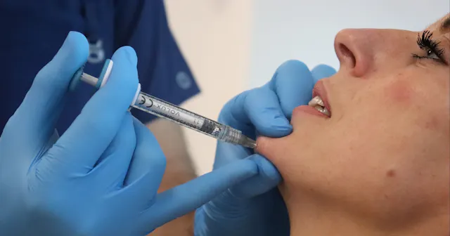 Chin Filler Injection Techniques for Feminisation | Harley Academy