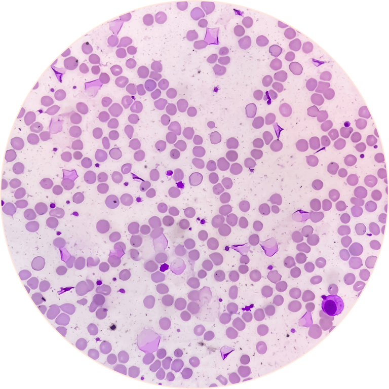 FeMe Complex | Wysokoprzyswajalne żelazo z laktoferyną