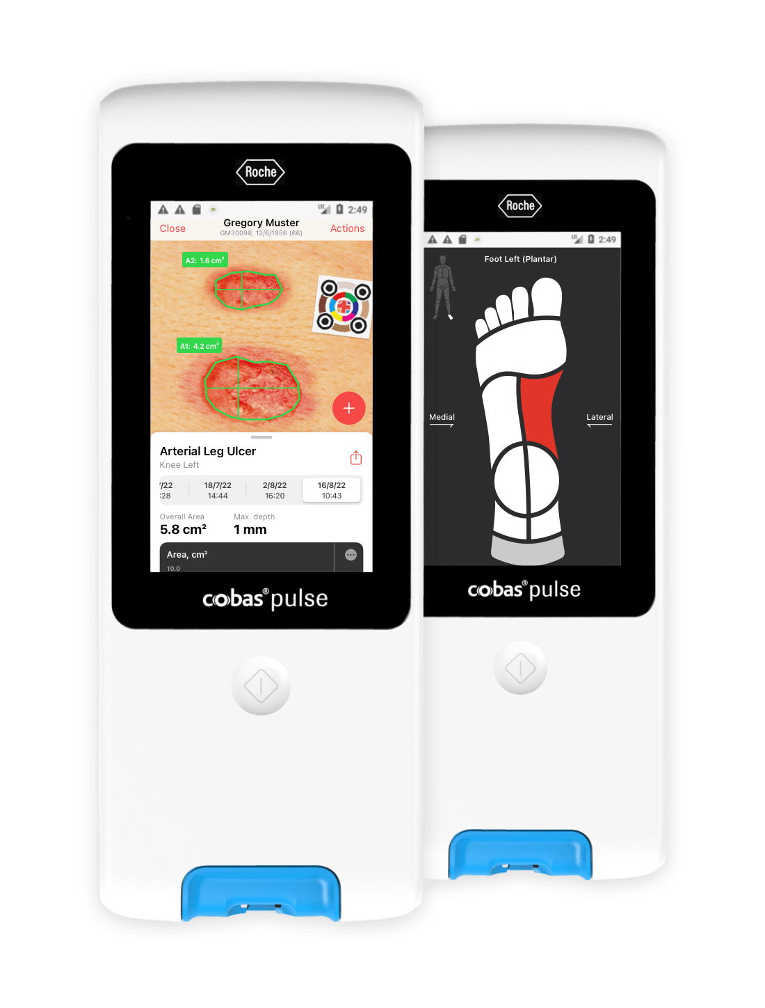 Wound management radically simplified