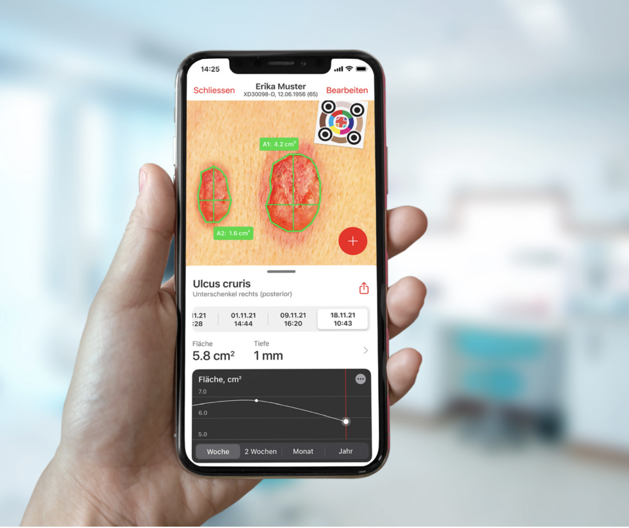 Wound measurement with imito - when to choose which measurement mode