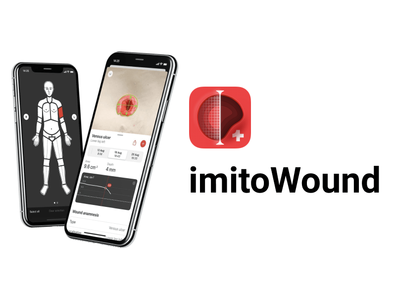 Wundvisite per app _ digitale wundvisite berlin – ICDK