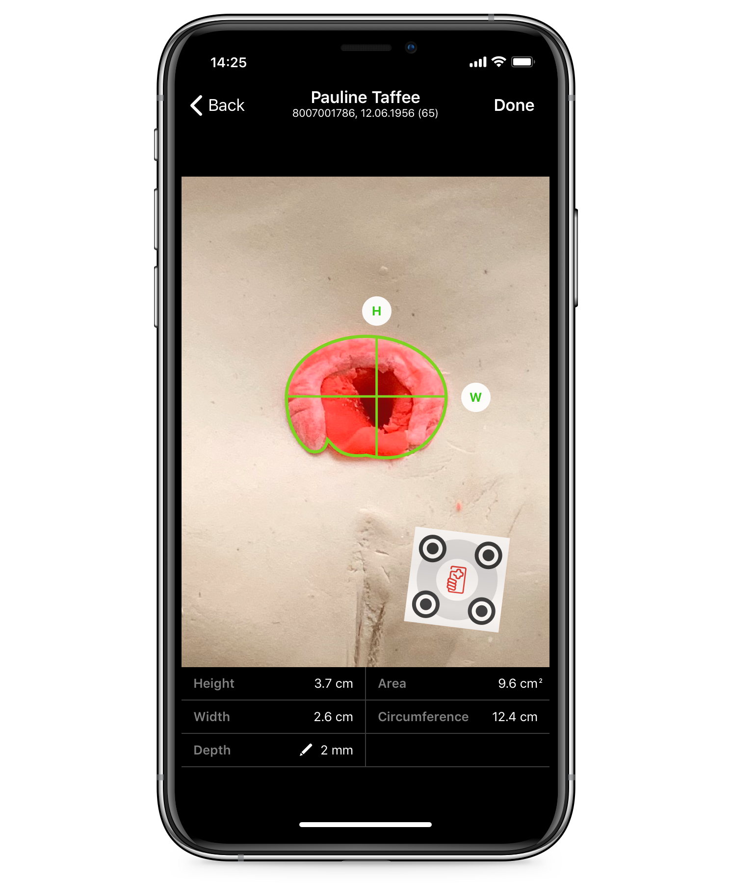 imitoWound — Wunddokumentation per App, standardisiert und bildzentriert