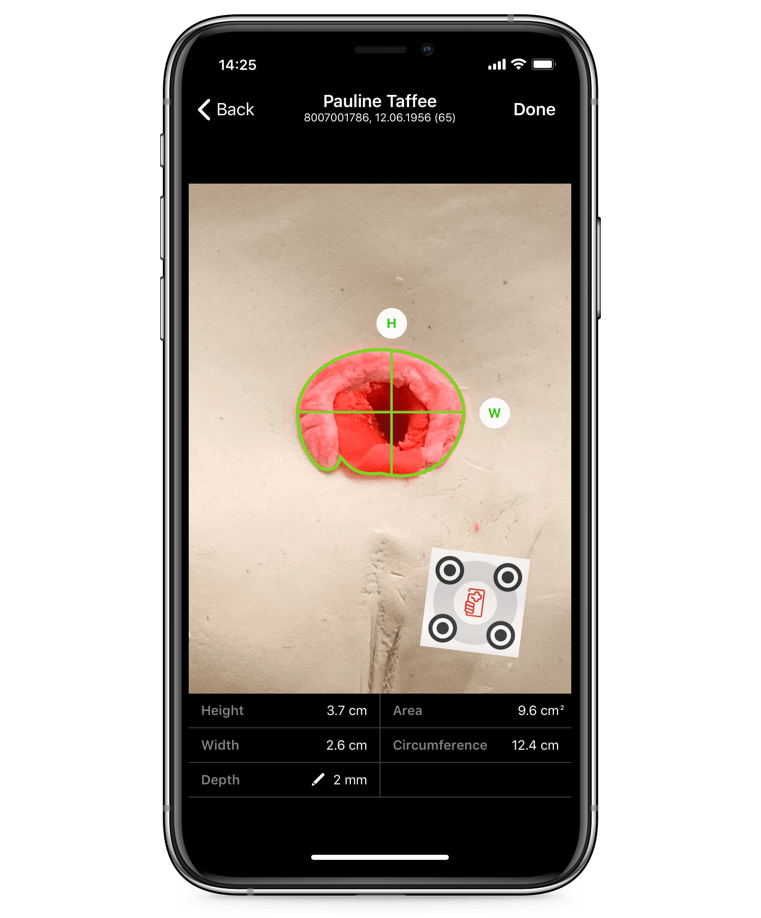 imitoWound — Wound documentation in a breeze, image-centred