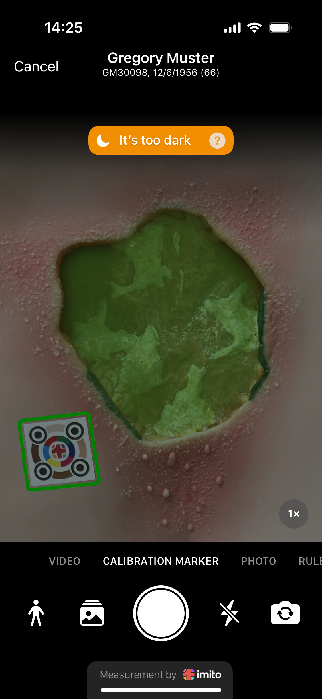 How to use imito's calibration markers