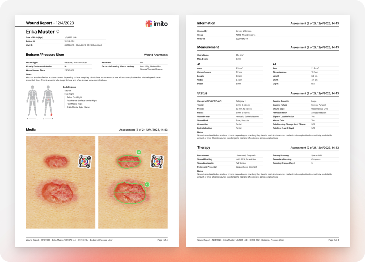 Wound documentation with printable wound report PDF