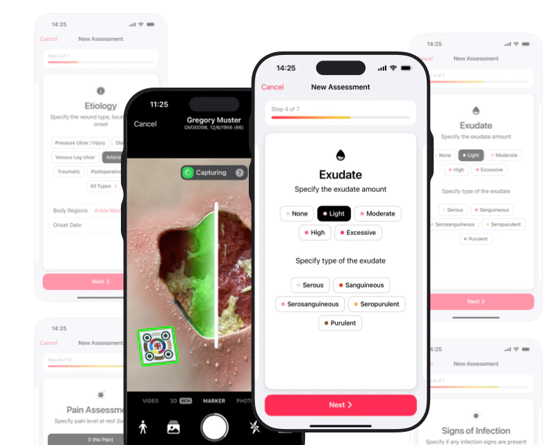 Free wound measurement app - imitoMeasure
