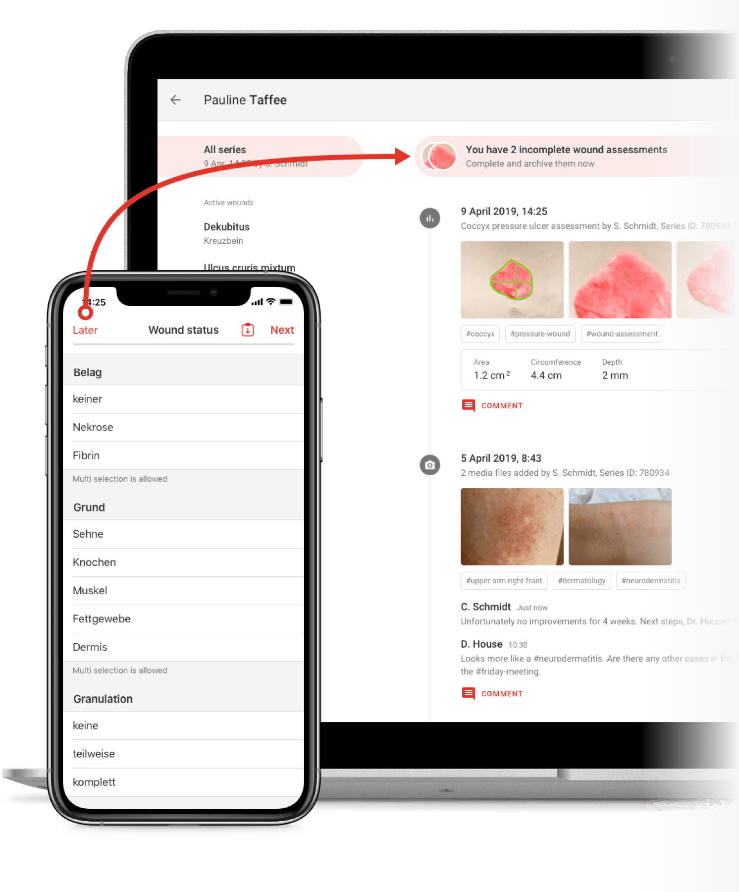 imitoWound — Wound documentation in a breeze, image-centred