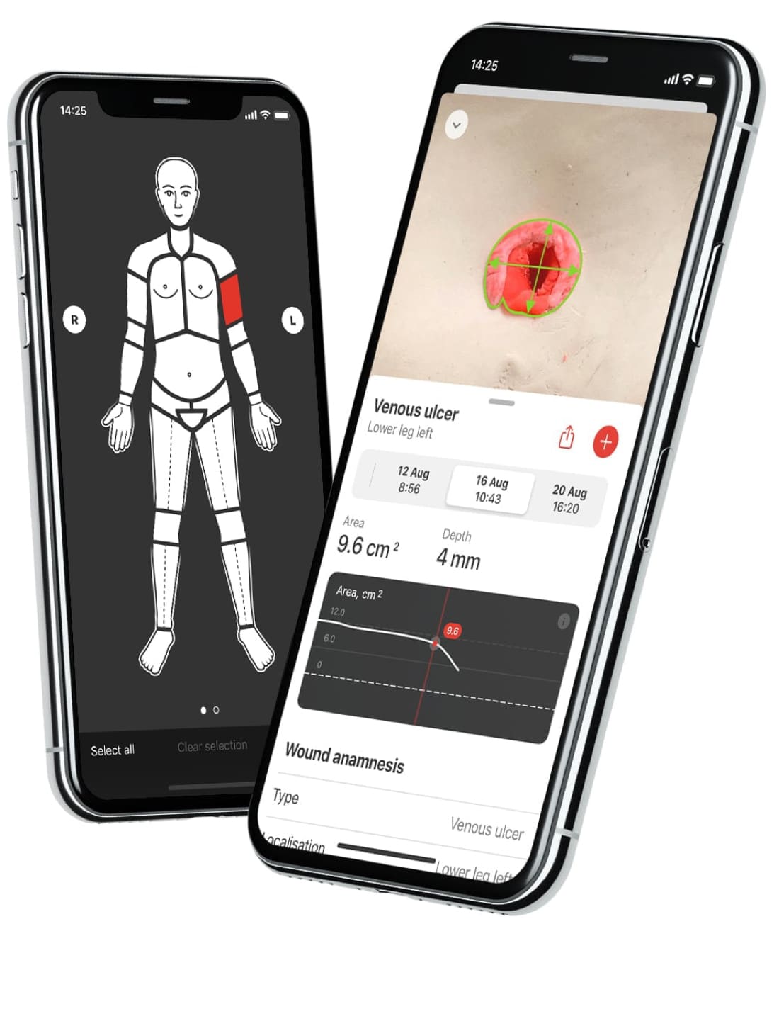 imitoWound — Wound documentation in a breeze, image-centred