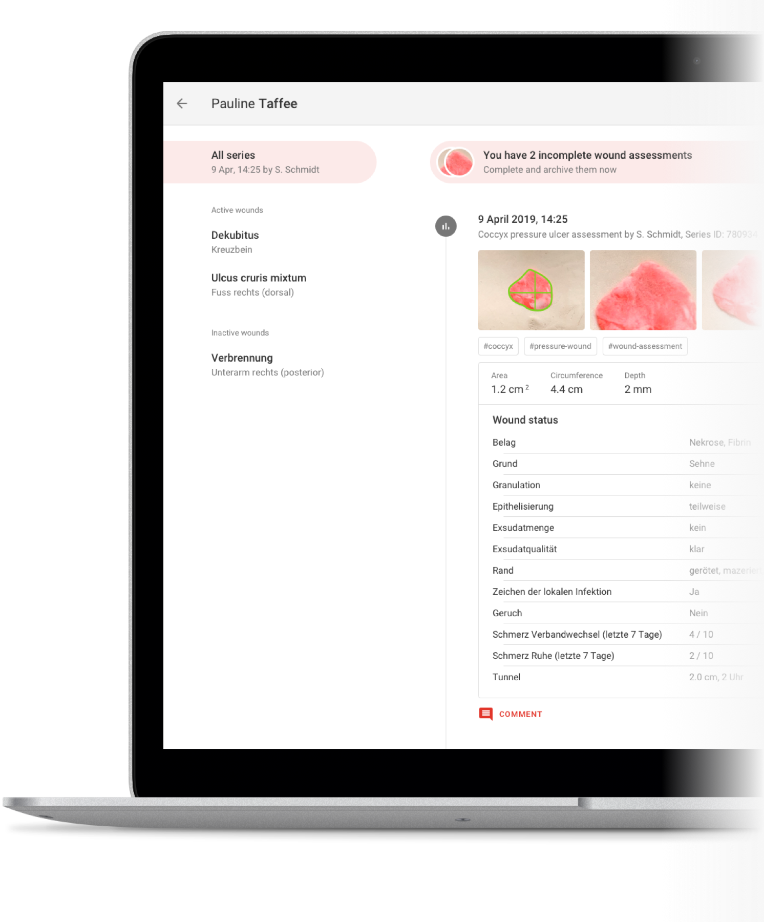 imitoWound — Wound documentation in a breeze, image-centred