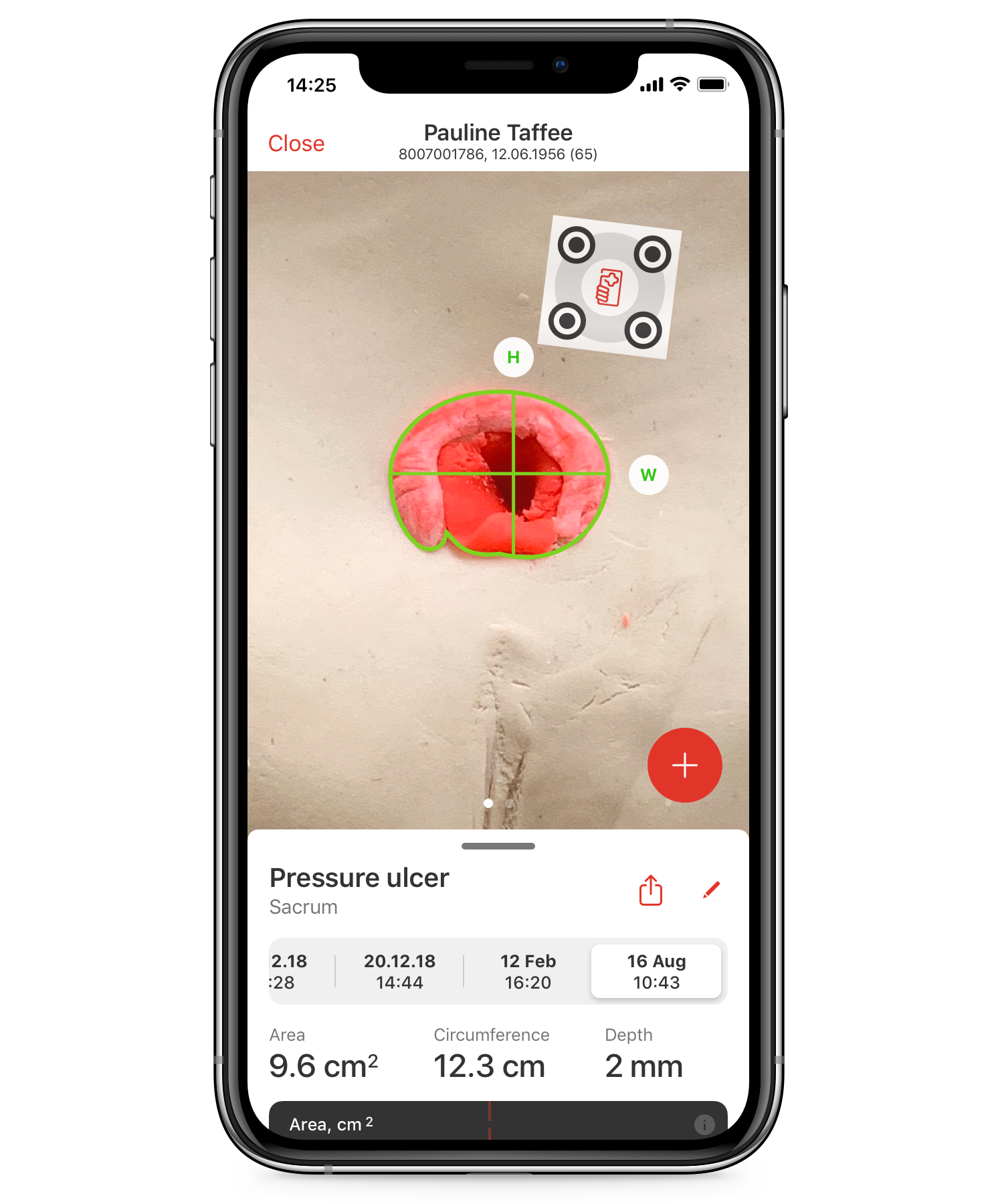 imitoWound — Wound documentation in a breeze, image-centred