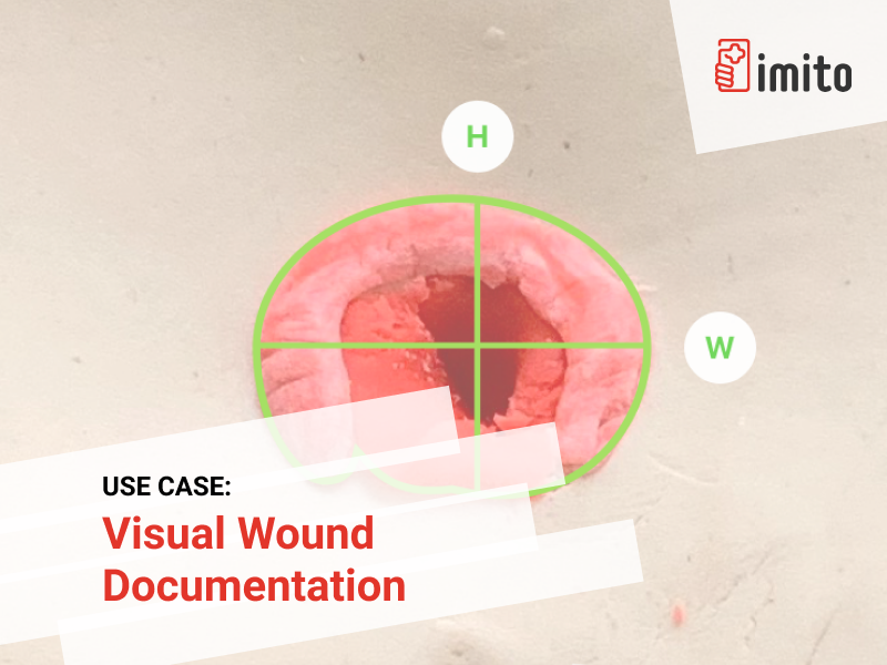 imito AG - Mobile Wound Documentation App