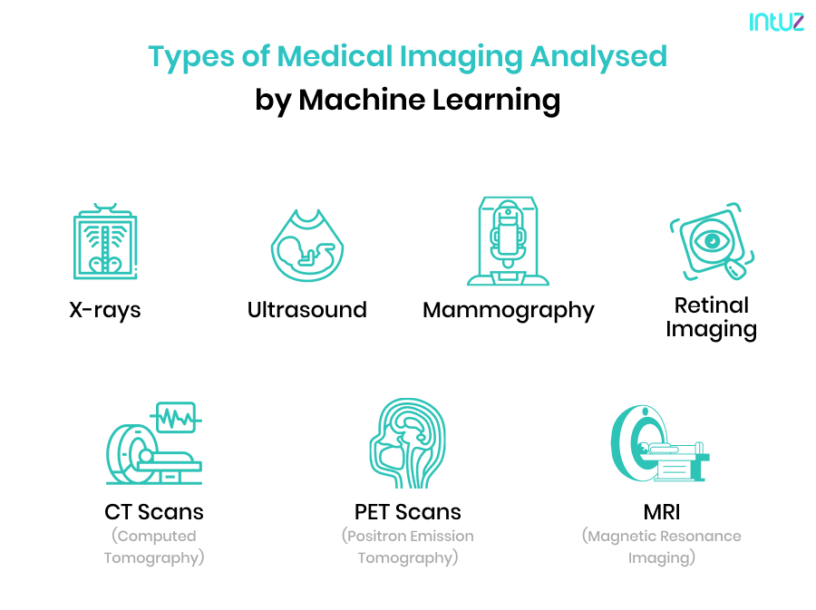 Machine Learning (ML) in Advanced Medical Imaging Analysis