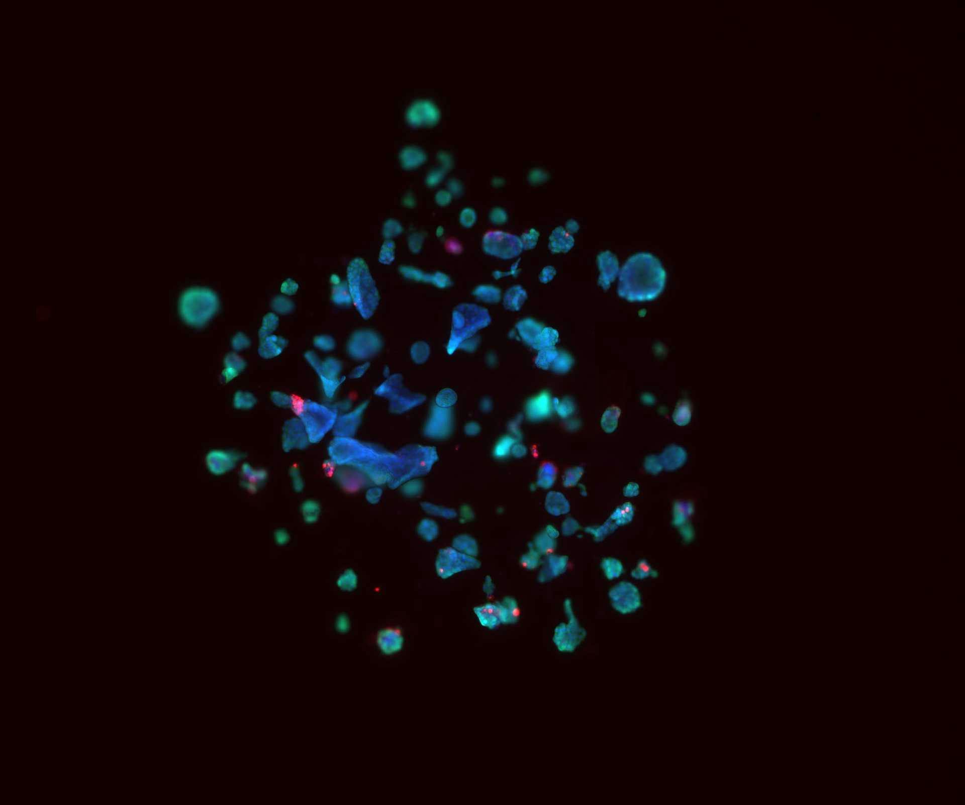 High Throughput Production Of Matrix Embedded Multicellular Tumour Spheroids By Drop On Demand