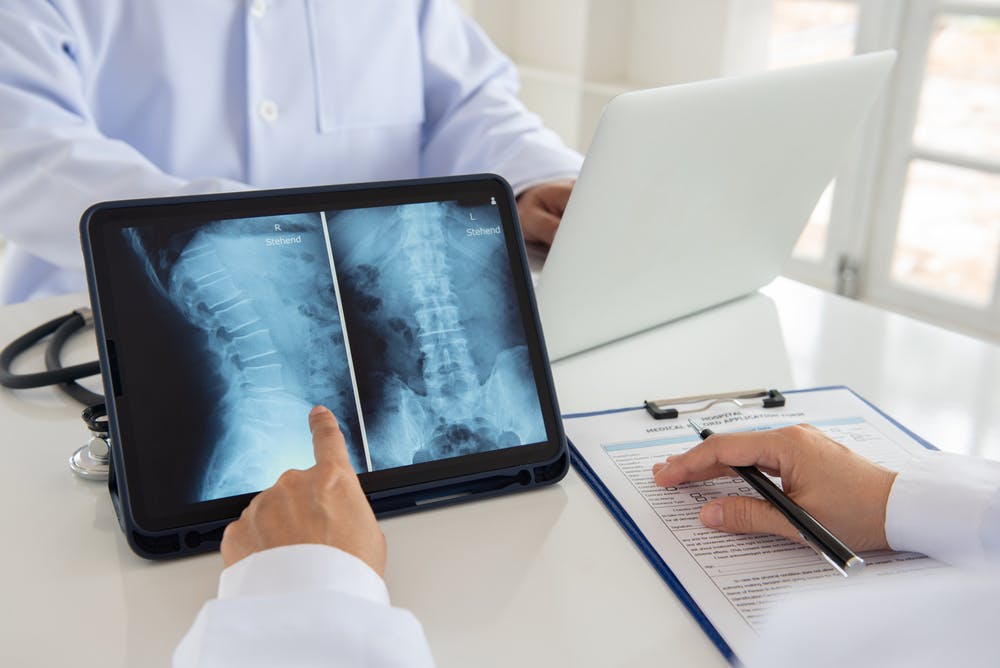 Cauda Equina Syndrome Tests - JMW Solicitors