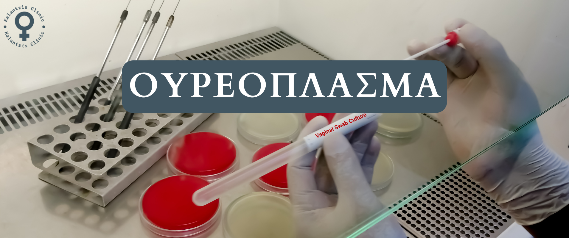 Ουρεόπλασμα- Τι είναι-Διάγνωση-Θεραπεία