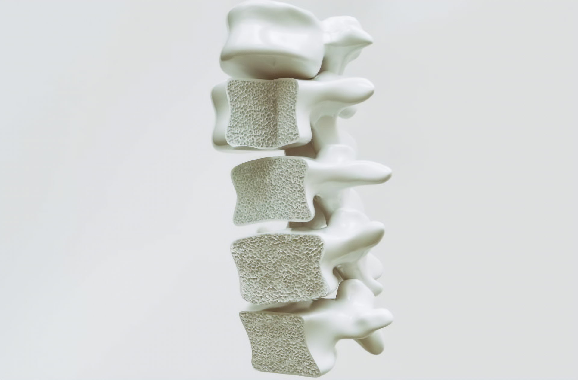 MEDCAN - Women and Bone Health