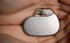 Implantare defibrilator cardiac | MONZA ARES