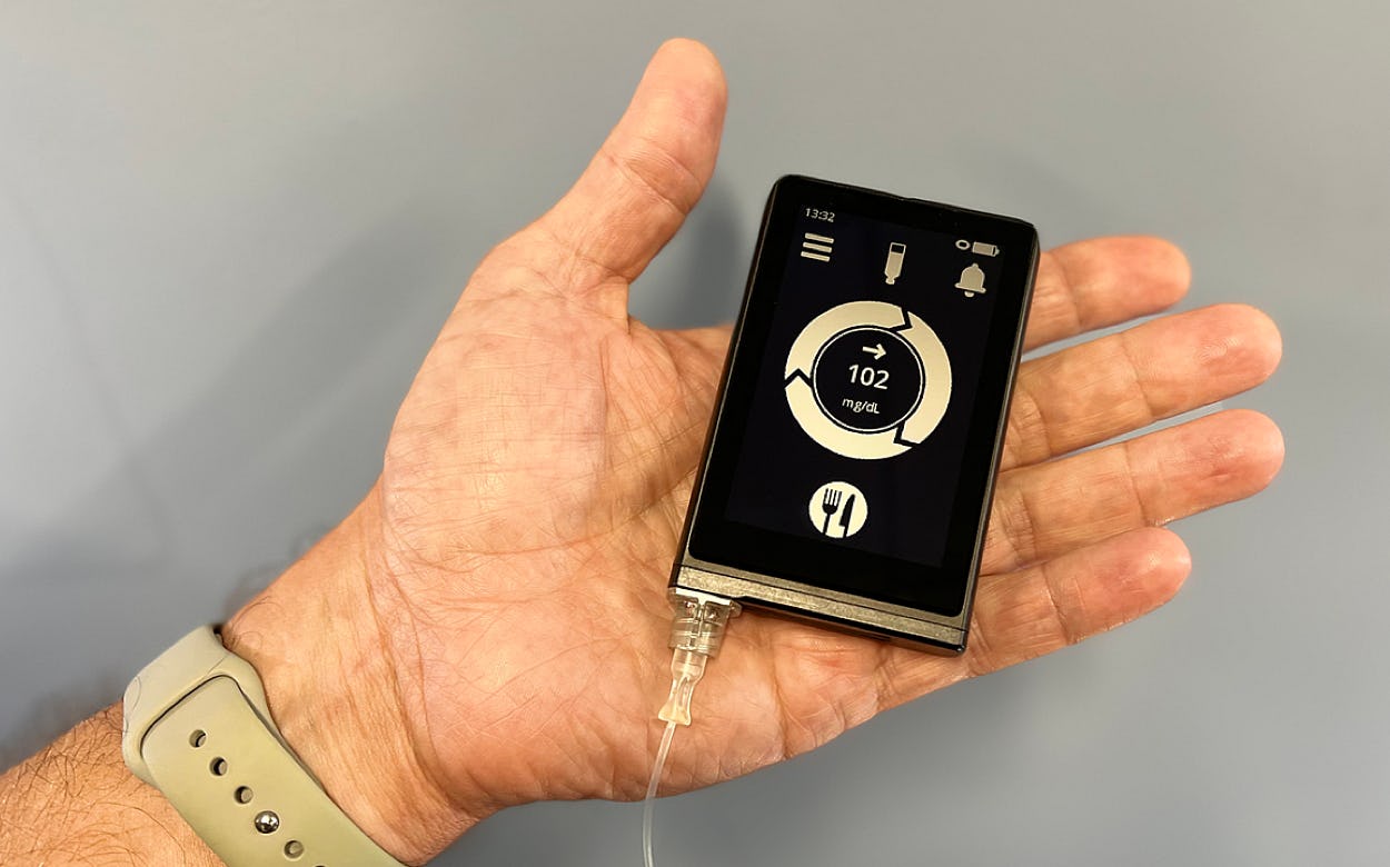 This smart bionic pancreas could regulate your insulin levels