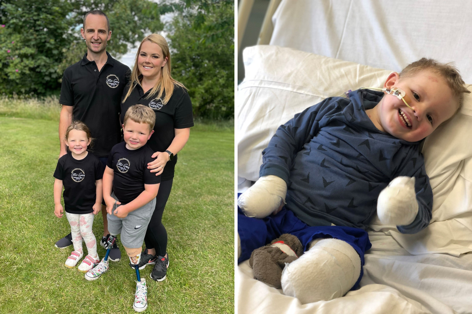 Mum's warning as son, 3, loses legs and fingers to hard-to-spot sepsis ...