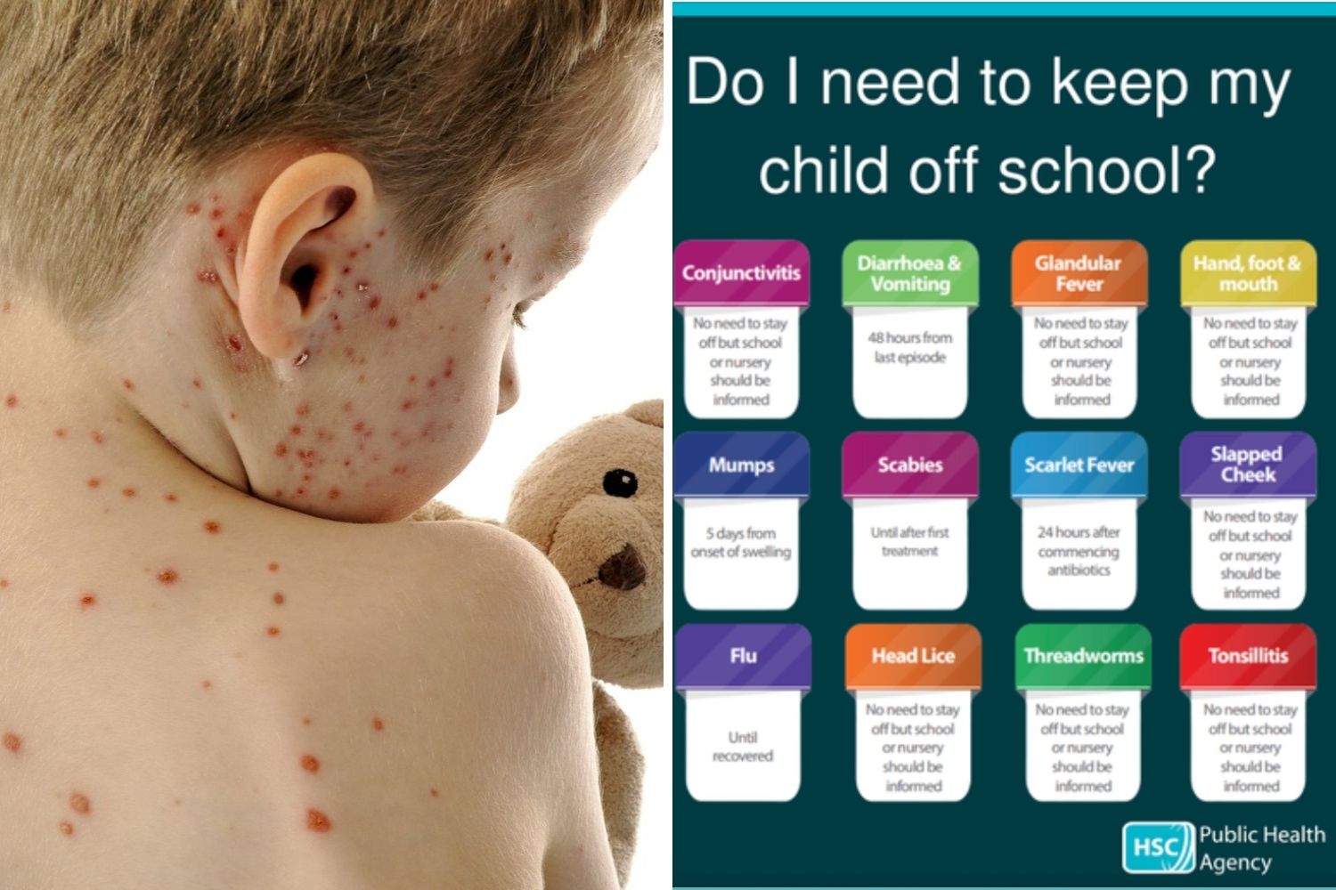 Handy poster reveals when you need to keep kids off school sick - Netmums