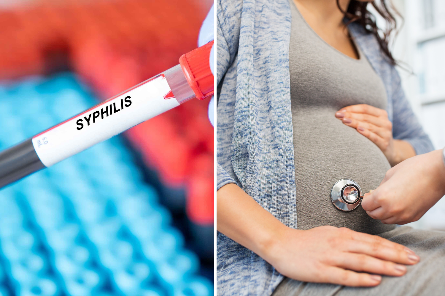 Doctors should check pregnant women for medieval STI, say health chiefs ...