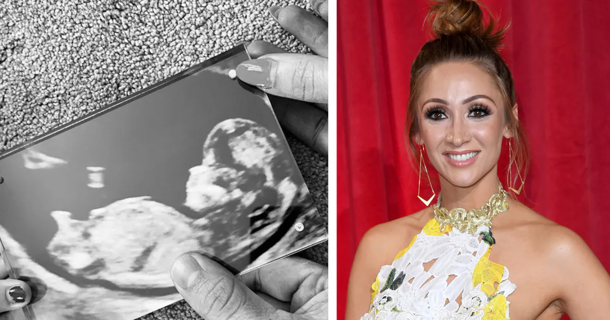 Corrie Star Lucy-Jo Hudson And Partner Lewis Devine Announce Pregnancy ...