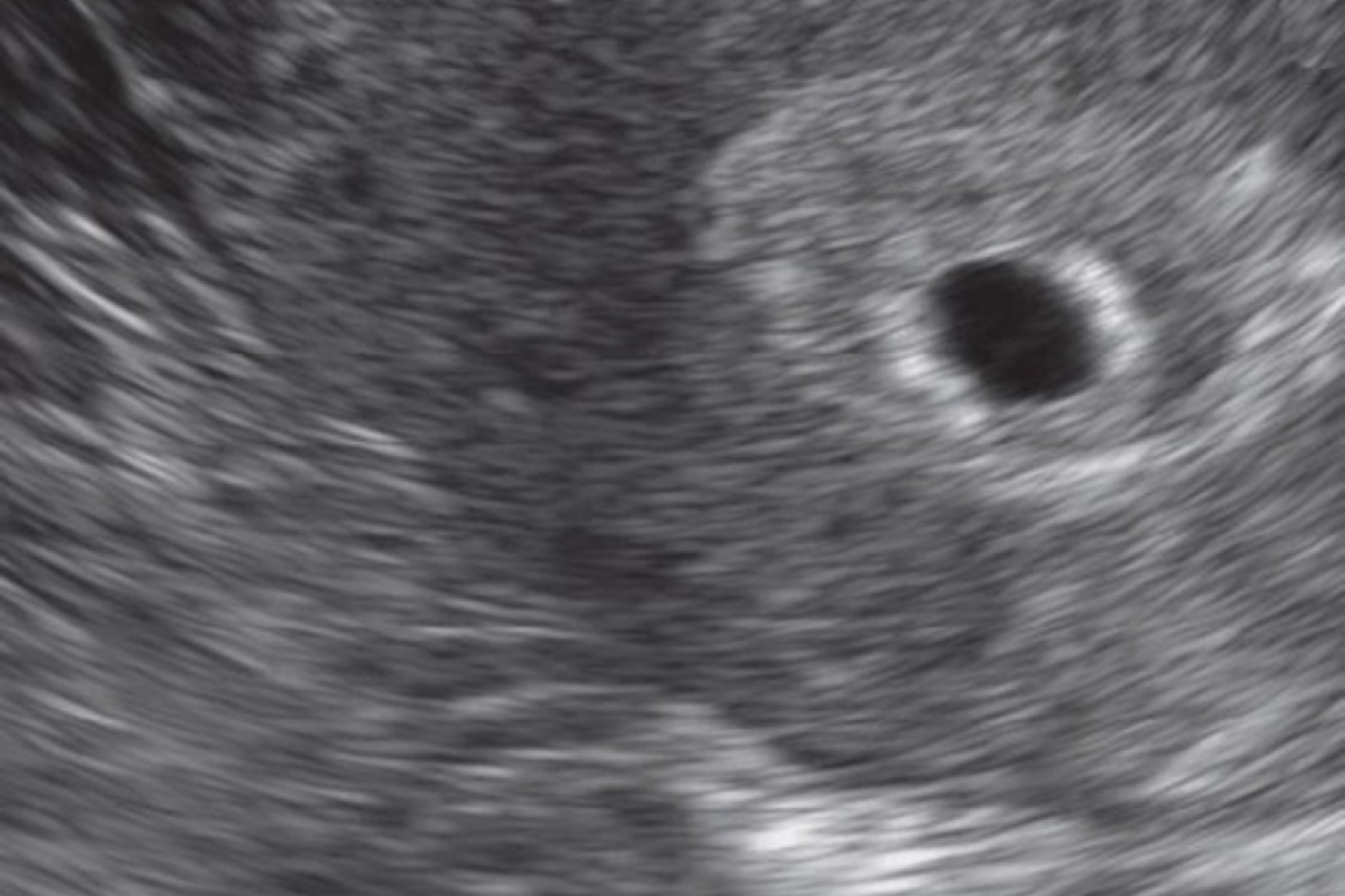 Week-by-Week Pregnancy Scan Photos Weeks 4-40 - Netmums