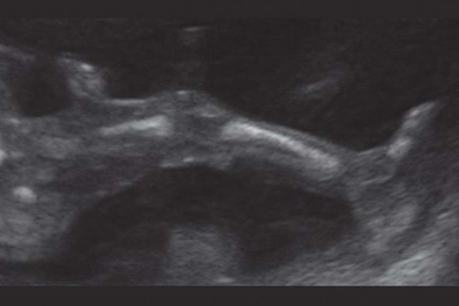 Week-by-Week Pregnancy Scan Photos Weeks 4-40 - Netmums