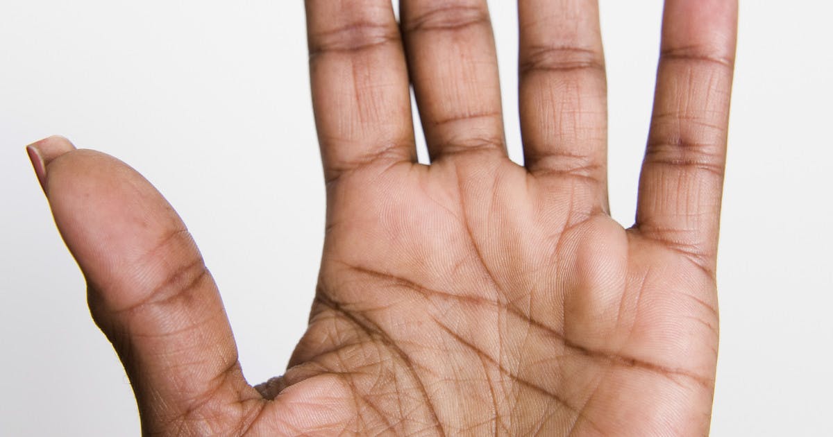 To smack or not to smack - the debate is reignited - Netmums