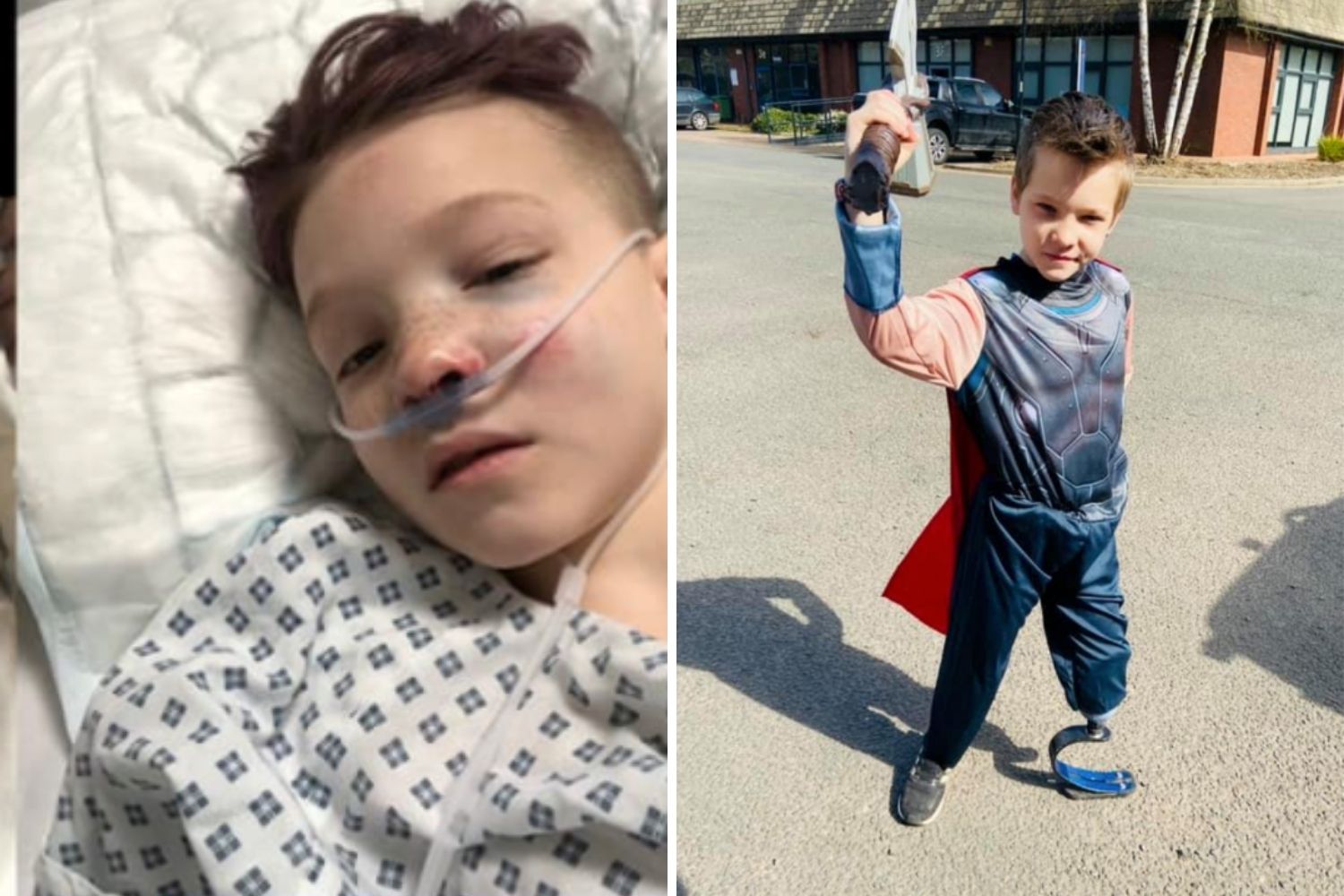 'My Son Lost His Leg In A Hit And Run – But Just Look At Him A Year On ...