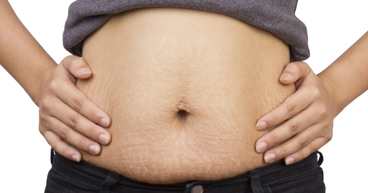 Your body after birth - Netmums