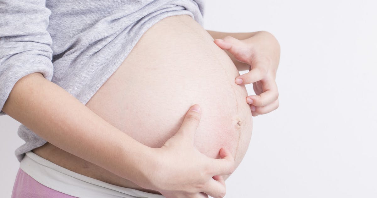 Itchy Skin In Pregnancy: Causes And Treatment - Netmums