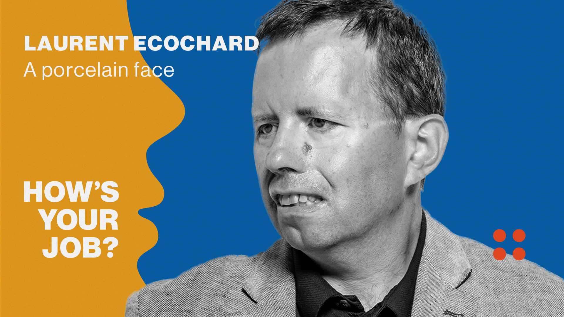 A Porcelain Face: Overcoming Moebius Syndrome