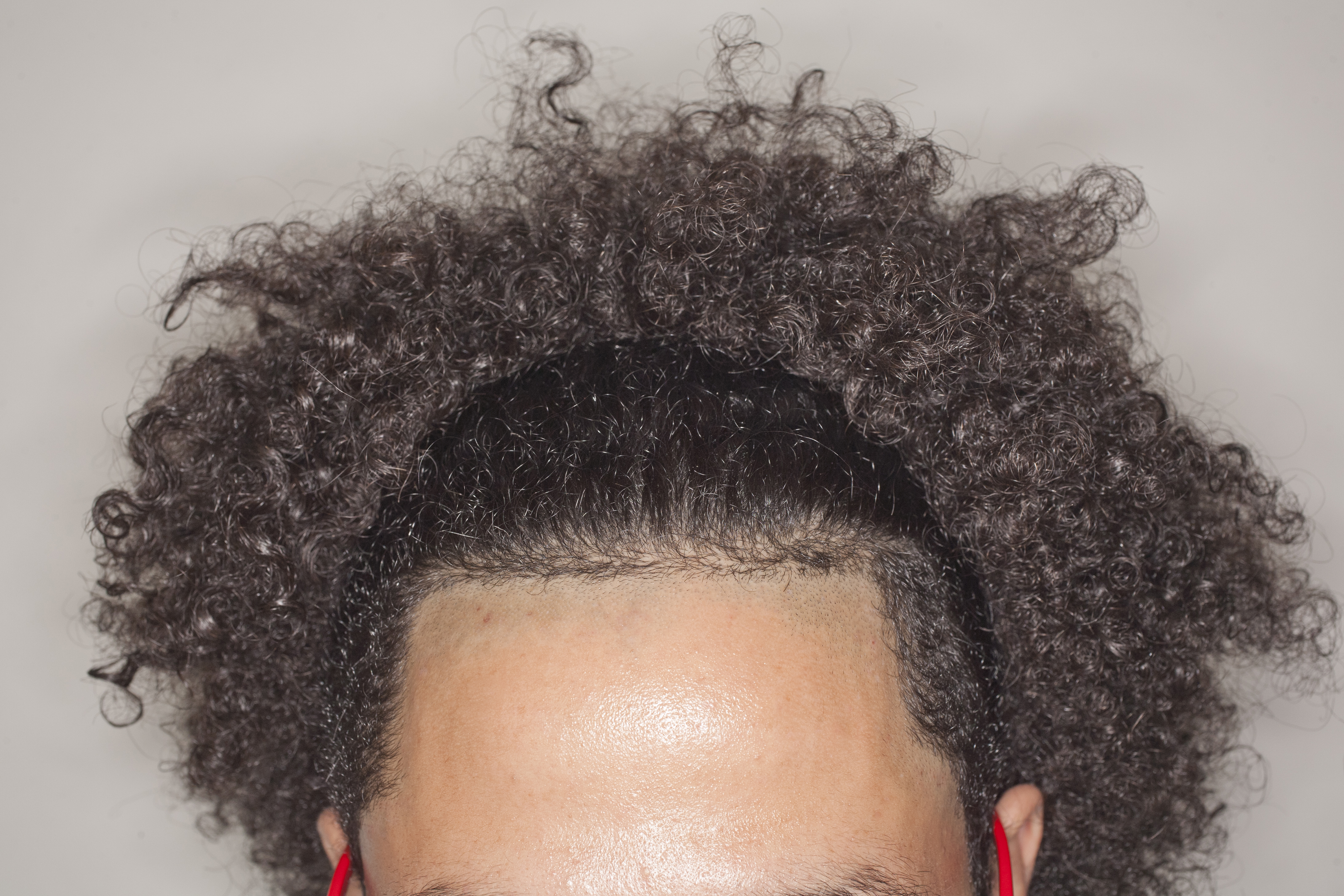 5 Natural Remedies For Healthier Edges | Nutrafol