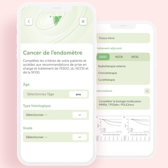 Cancer de l'endomètre : quelle prise en charge ? - PulseLife